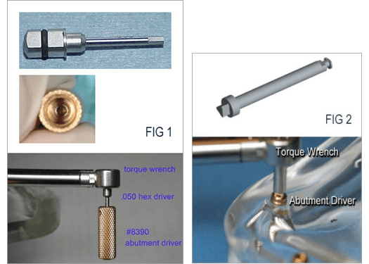 Attachments for Dentures - Global Dental Solutions