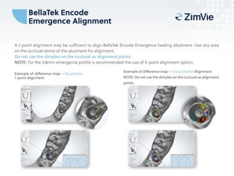 ZimVie Path of Digital Dentistry - Implant Solutions