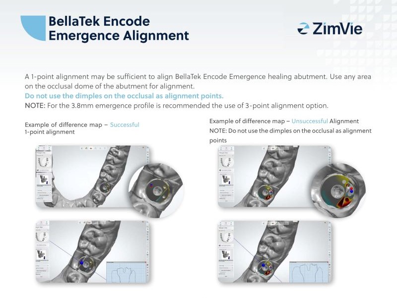 Zimvie Implant Solutions for Dental Professionals Nationwide