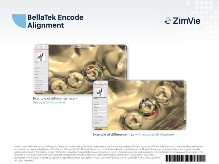 Zimvie Implant Solutions for Dental Professionals Nationwide