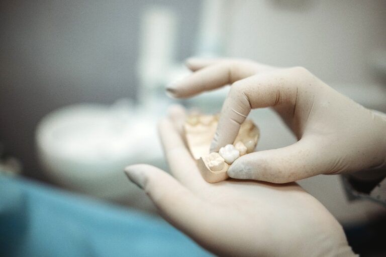 Discover How to Avoid Common Dental Impression Errors