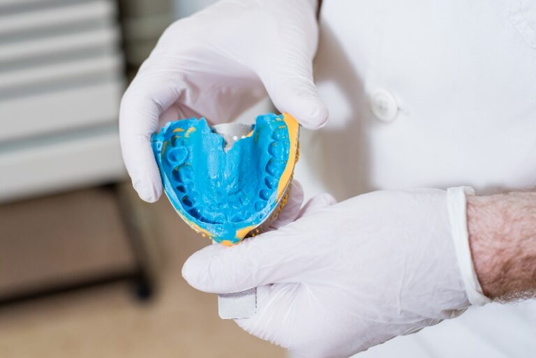 Discover How to Avoid Common Dental Impression Errors