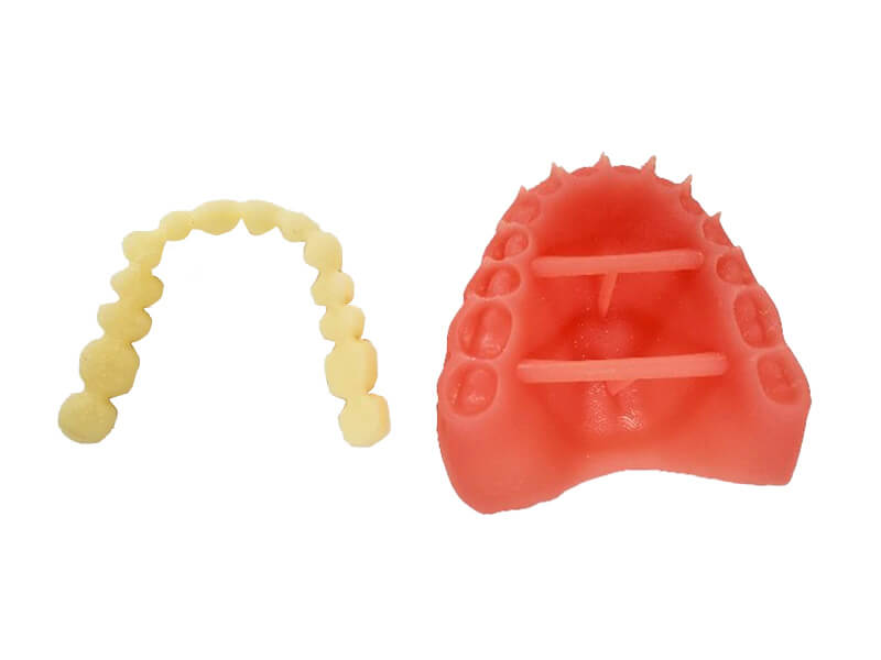 Cutting-Edge Digital Dentures in Atlanta, GA