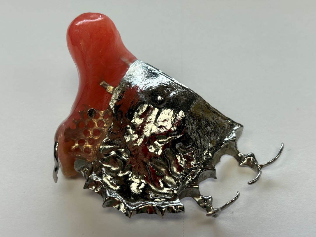 Palatal Obturators by Global Dental Solutions