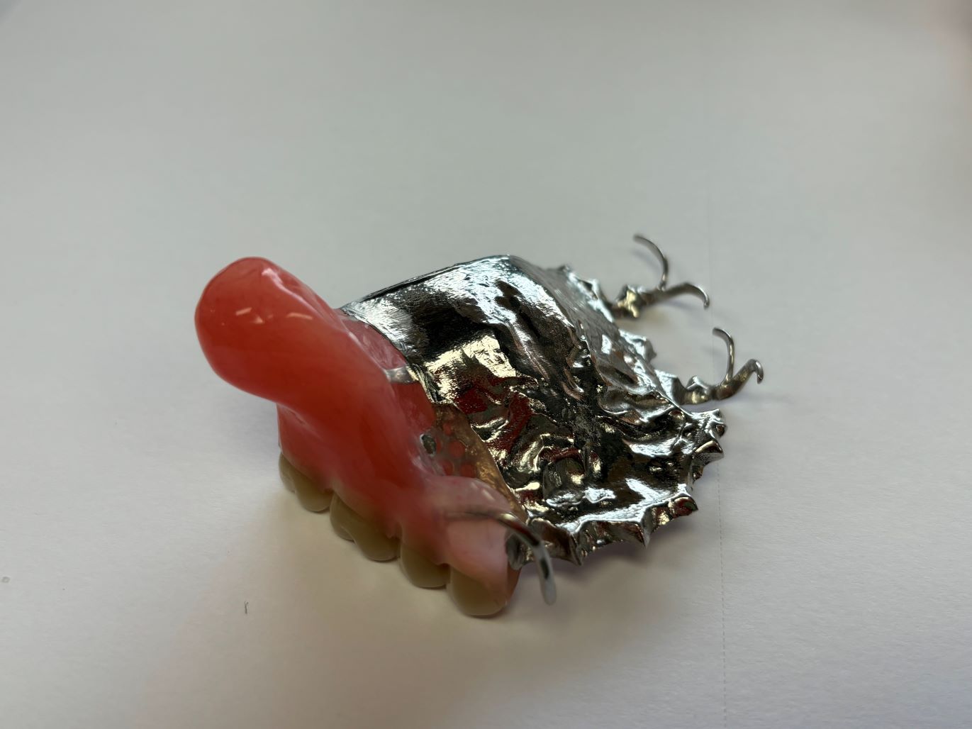 Palatal Obturators by Global Dental Solutions
